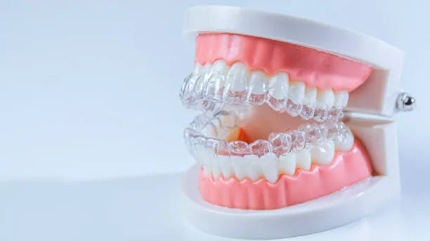 crossbite correction with aligners