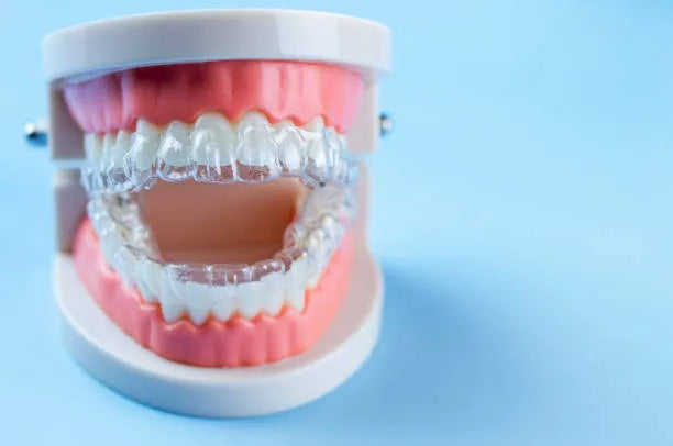 Overbite: Can Retainers Fix It? Best Options Explained – NewSmile™ USA