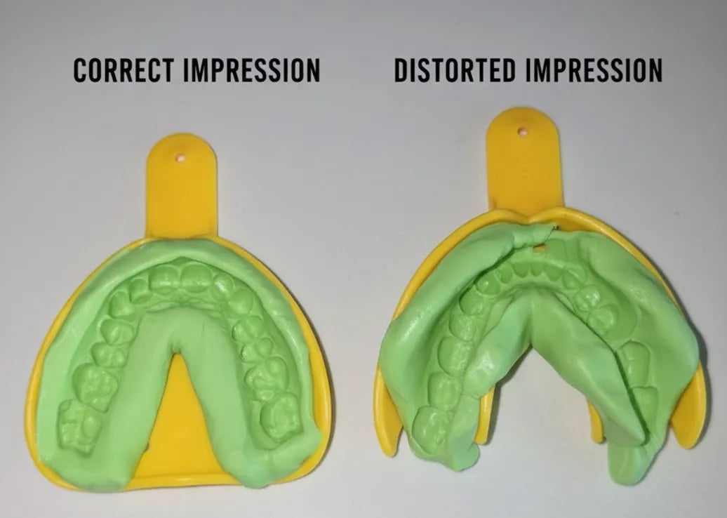 Precision in Dental Impressions: Key to Accurate Results – NewSmile™ USA