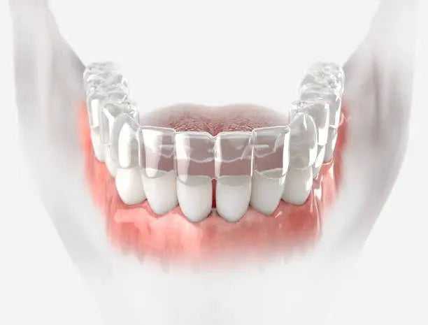 Can Retainers Close Gap Teeth? A Guide | NewSmile – NewSmile™ USA